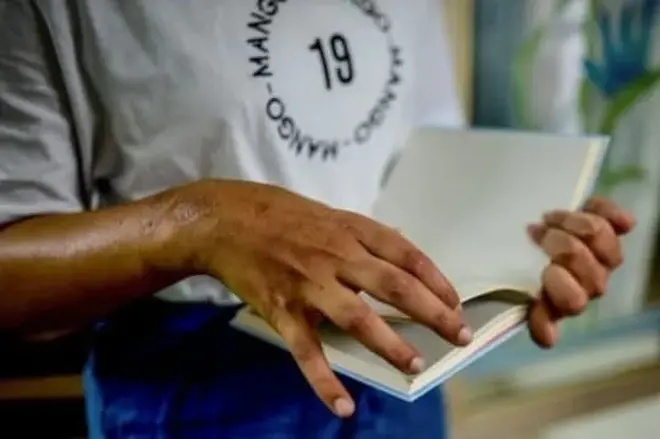 Le trasplantaron dos brazos de hombre y sorprendió a la ciencia