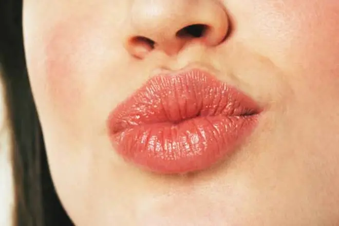 ¿El frío partió tus labios? Cúralos rápido con estos trucos