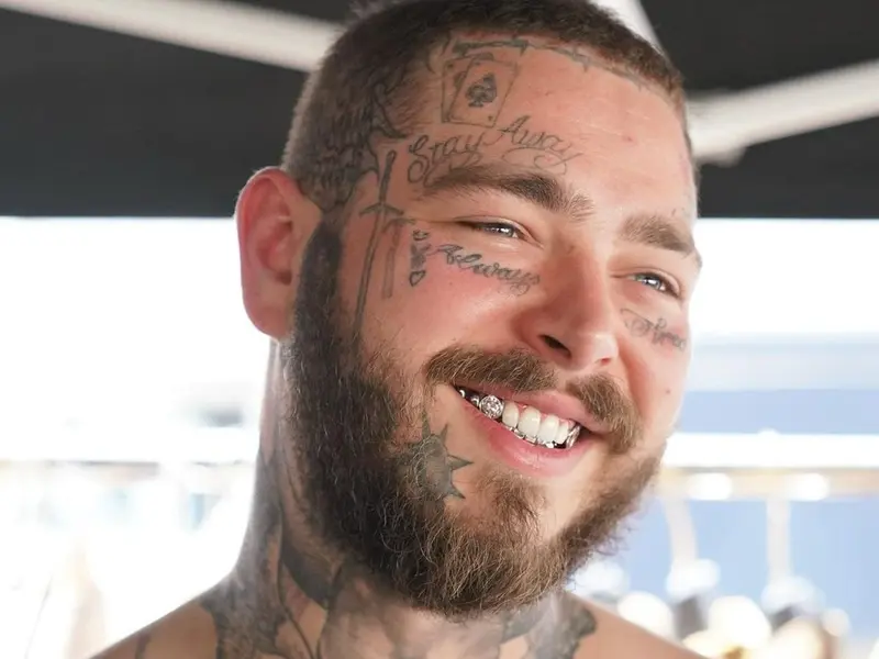 Video: Post Malone cae de escenario y se lesiona las costillas