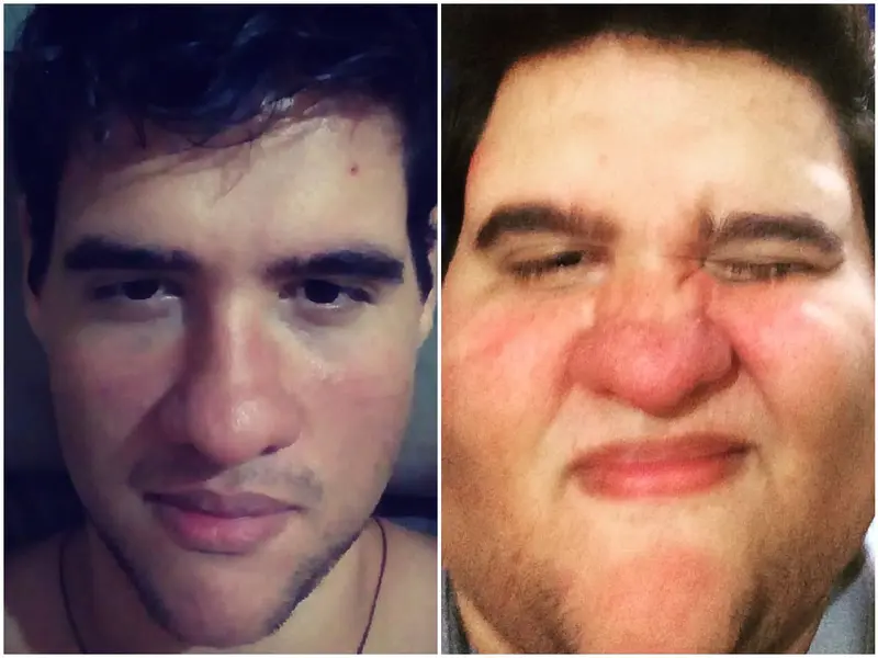 Murió Gabriel Freitas, influencer brasileño, tras su lucha contra la ...