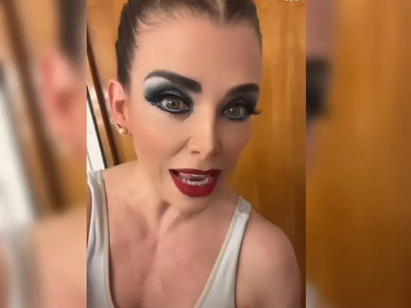 Lisset se cae a una coladera de CDMX y muestra las heridas que tuvo tras accidente