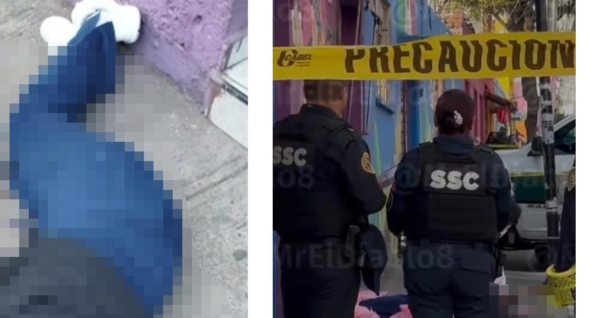 Se queja de ‘lipo’ mal hecha y la matan en CDMX; sospechan del cirujano