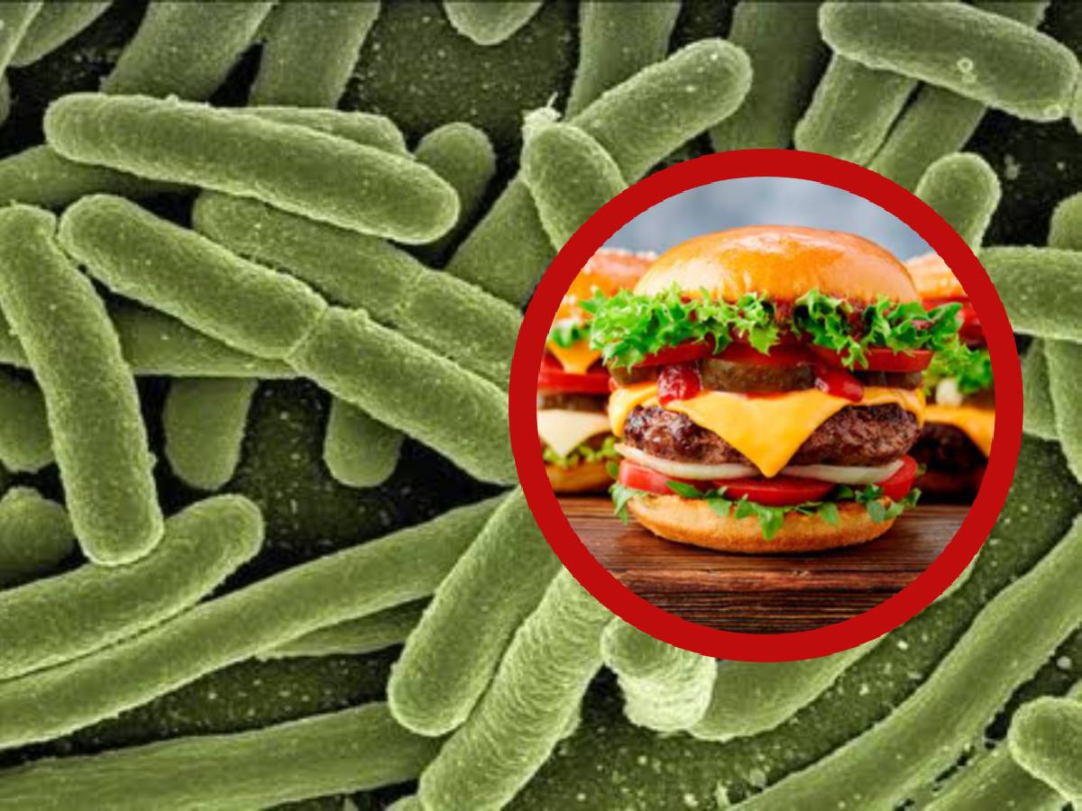 Infección de E. coli deja un muerto y 10 hospitalizados; comida de ...