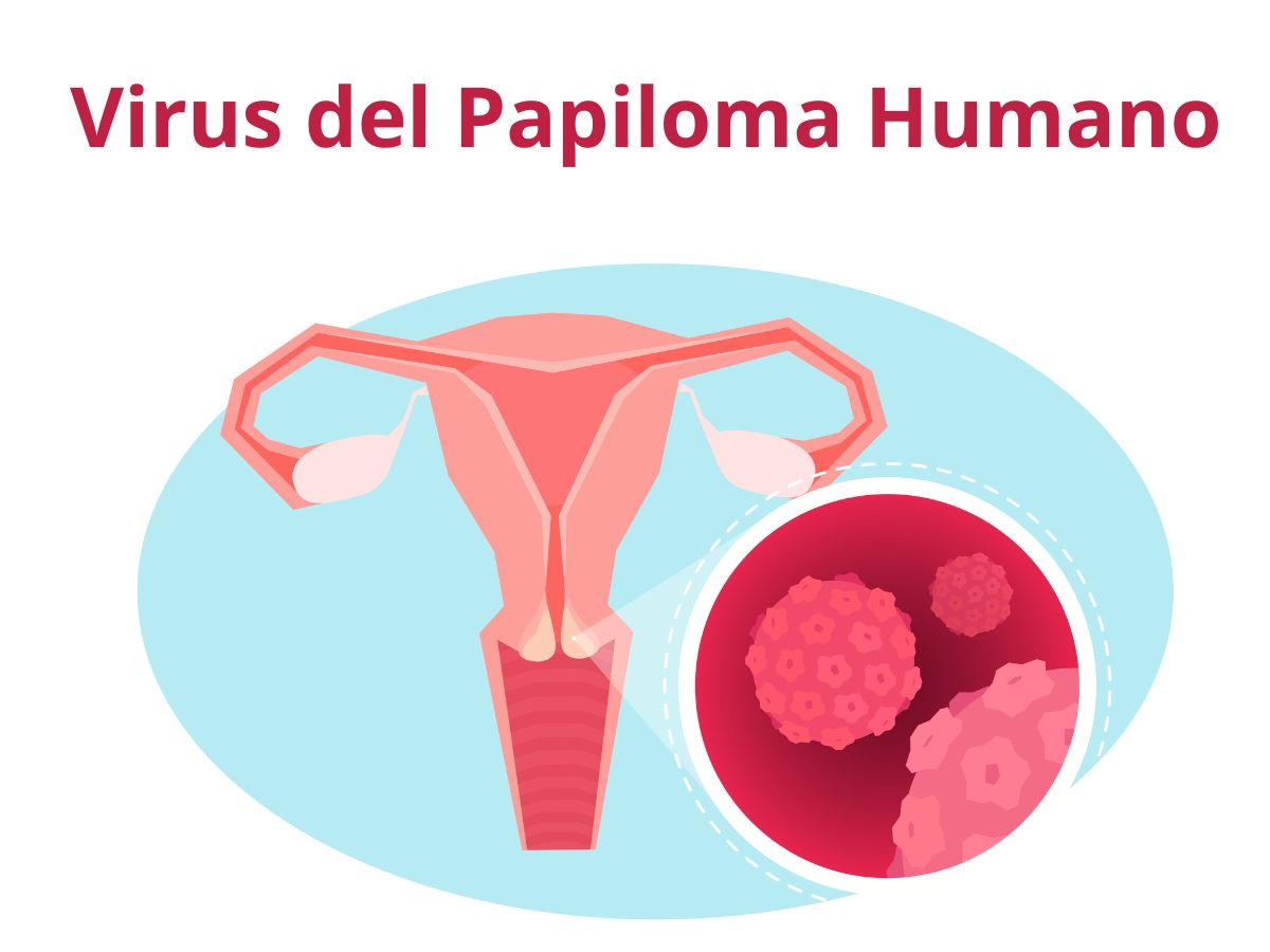 Cómo saber si tienes el Virus del Papiloma Humano